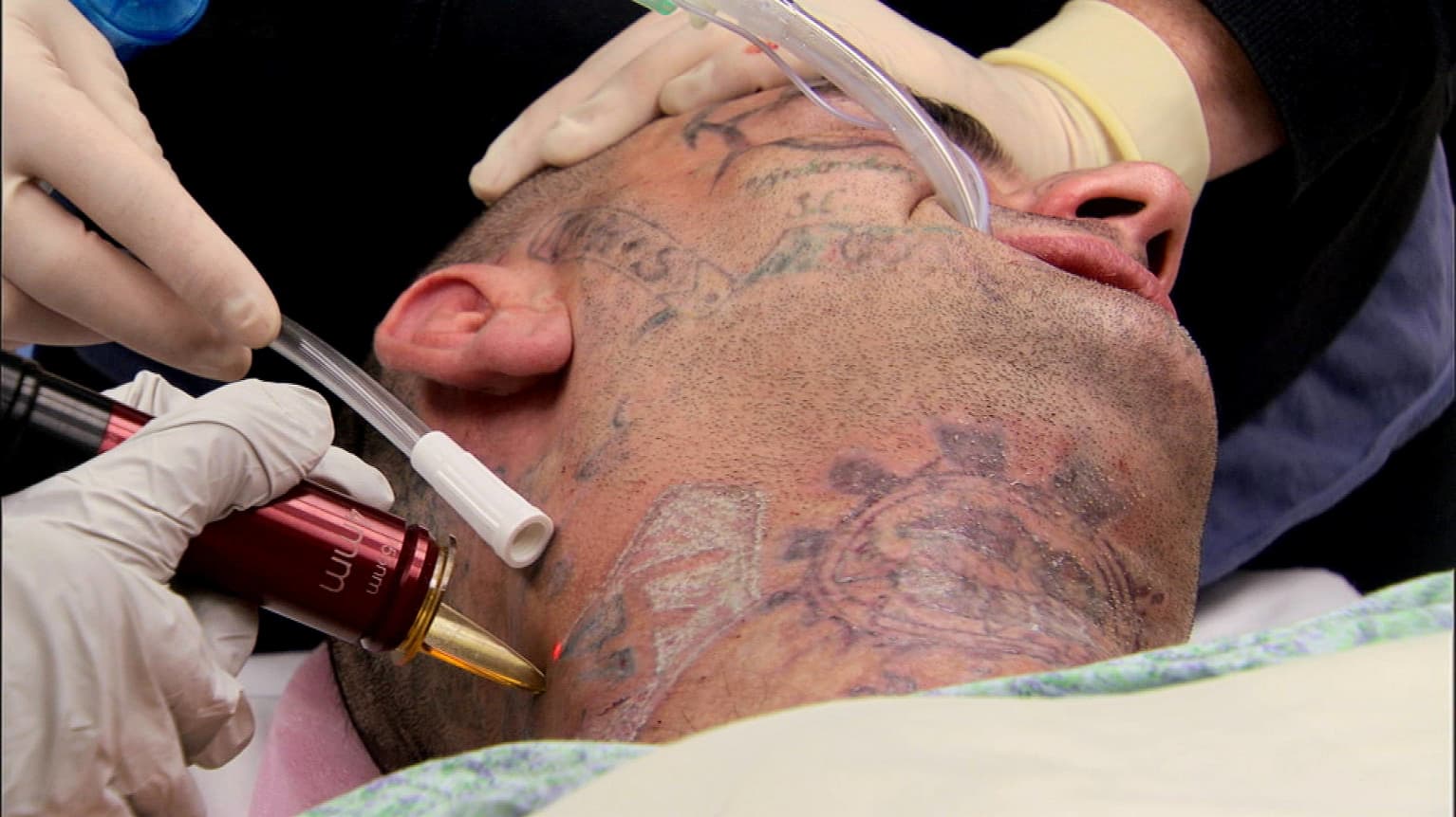 erasing hate bryon widner