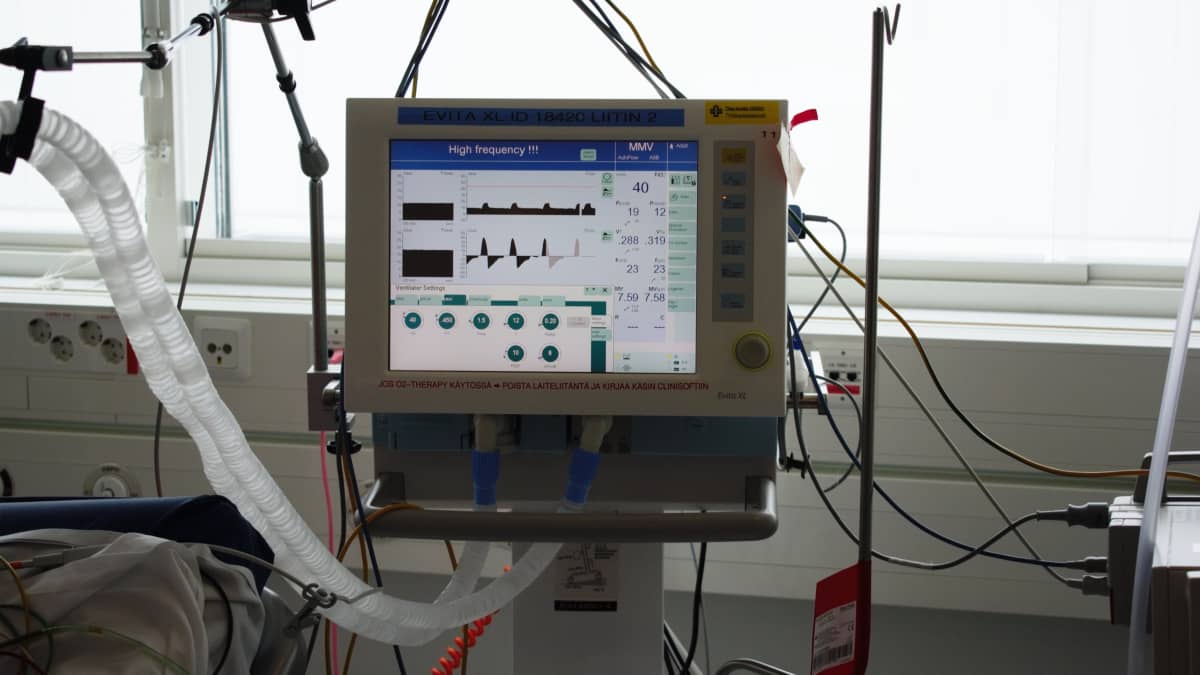Koronapotilaiden tehohoito lyhentynyt – keuhkovaurioita hillitsevä ...