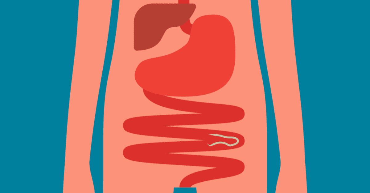 Hur vanligt är spolmask i Finland? Om du har otur kan du hosta ut en ...