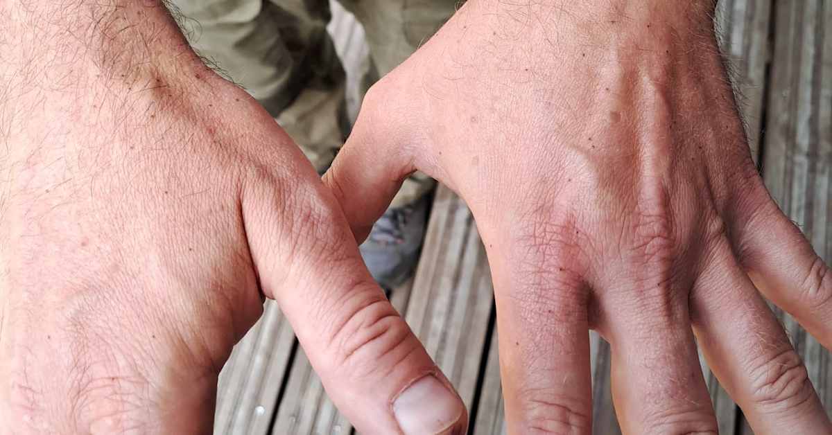 ”Vi sopade bort dem med en borste” – cirka 50 fästingar kröp längs ...