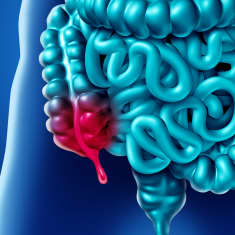 Blindtarm | Svenska Yle | Nyheter, sport, händelser