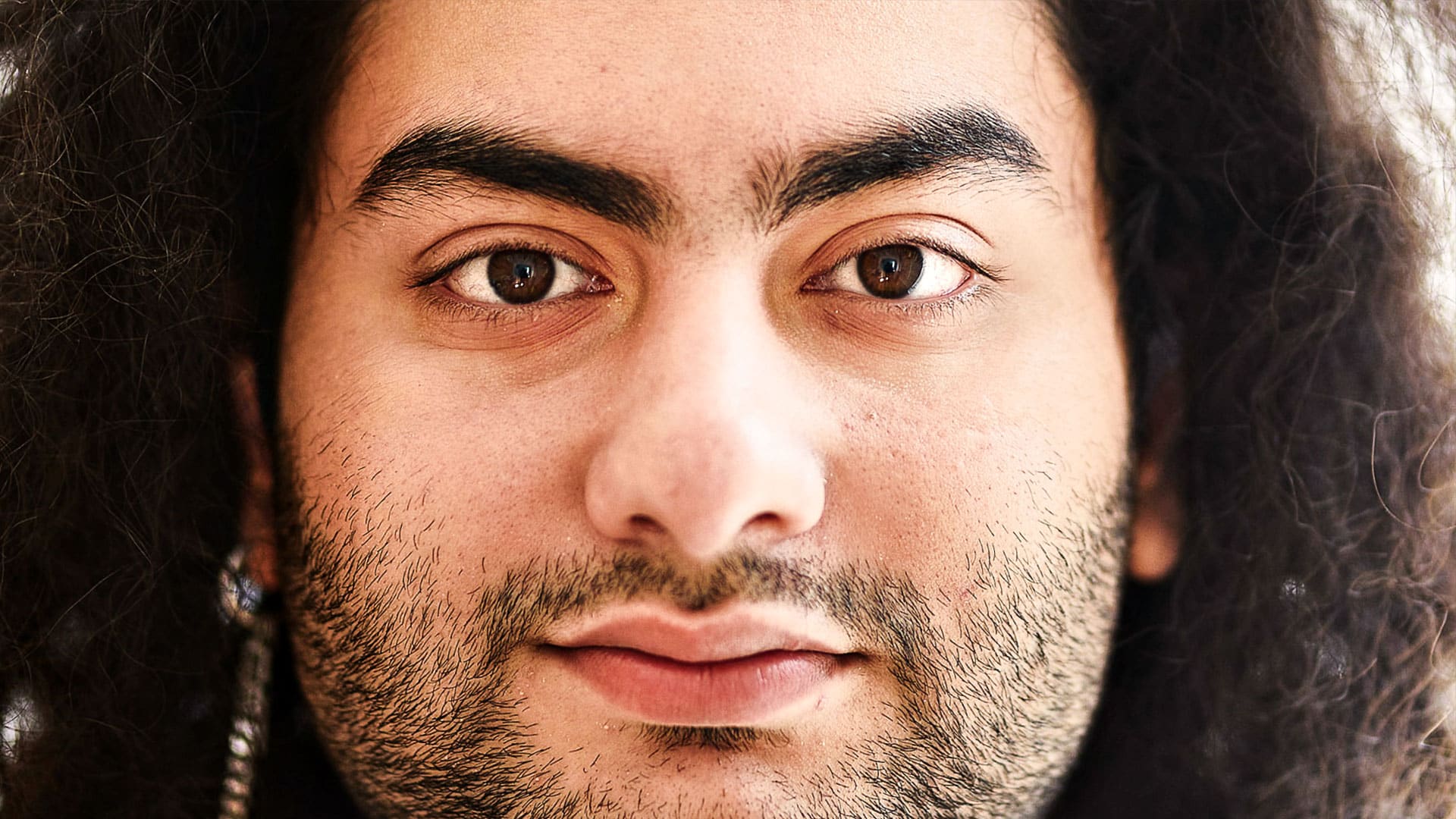 Star shaped scar | Yle Areena