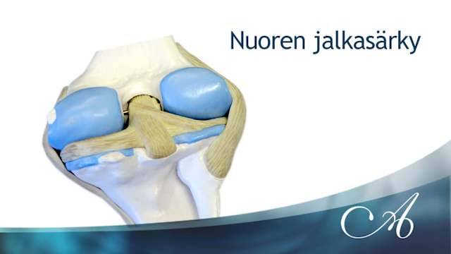 Polvikipu – Omalääkäri – yle.fi