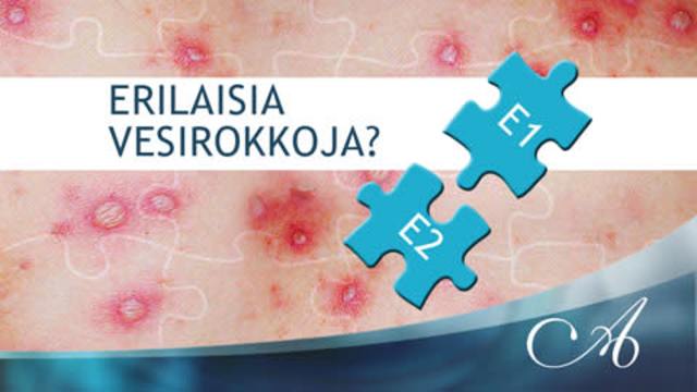 Vesirokon eri kannat – Omalääkäri – yle.fi