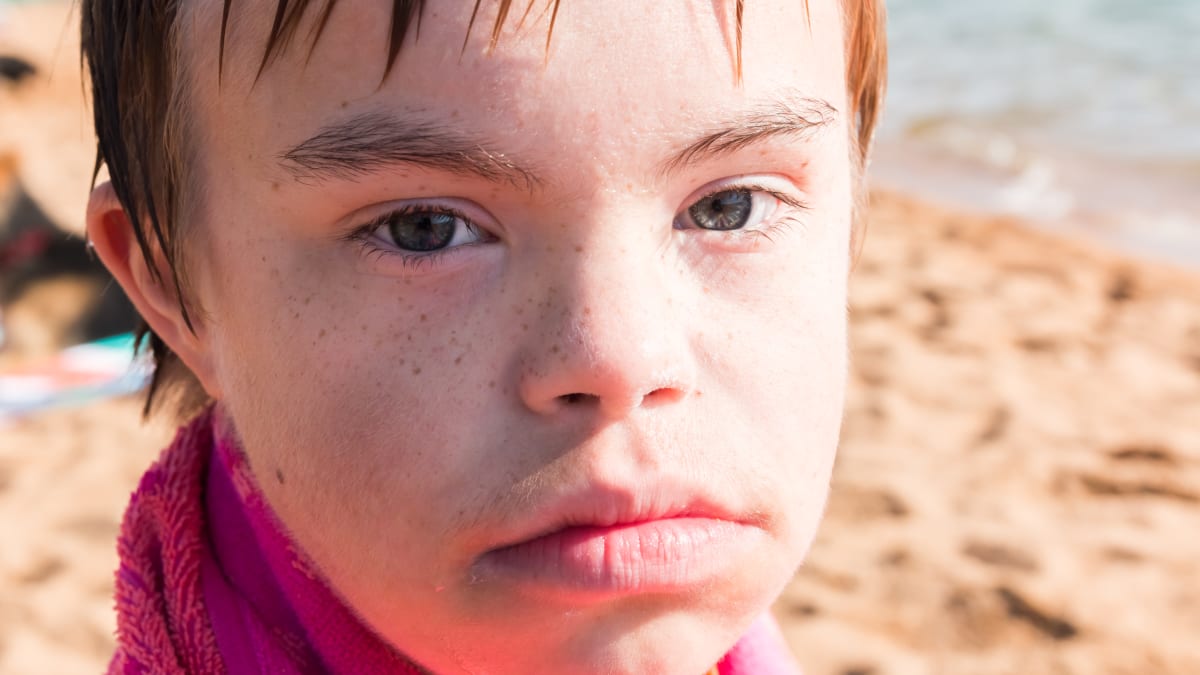 Vårdpersonal måste bli bättre på att ge besked om Downs syndrom ...