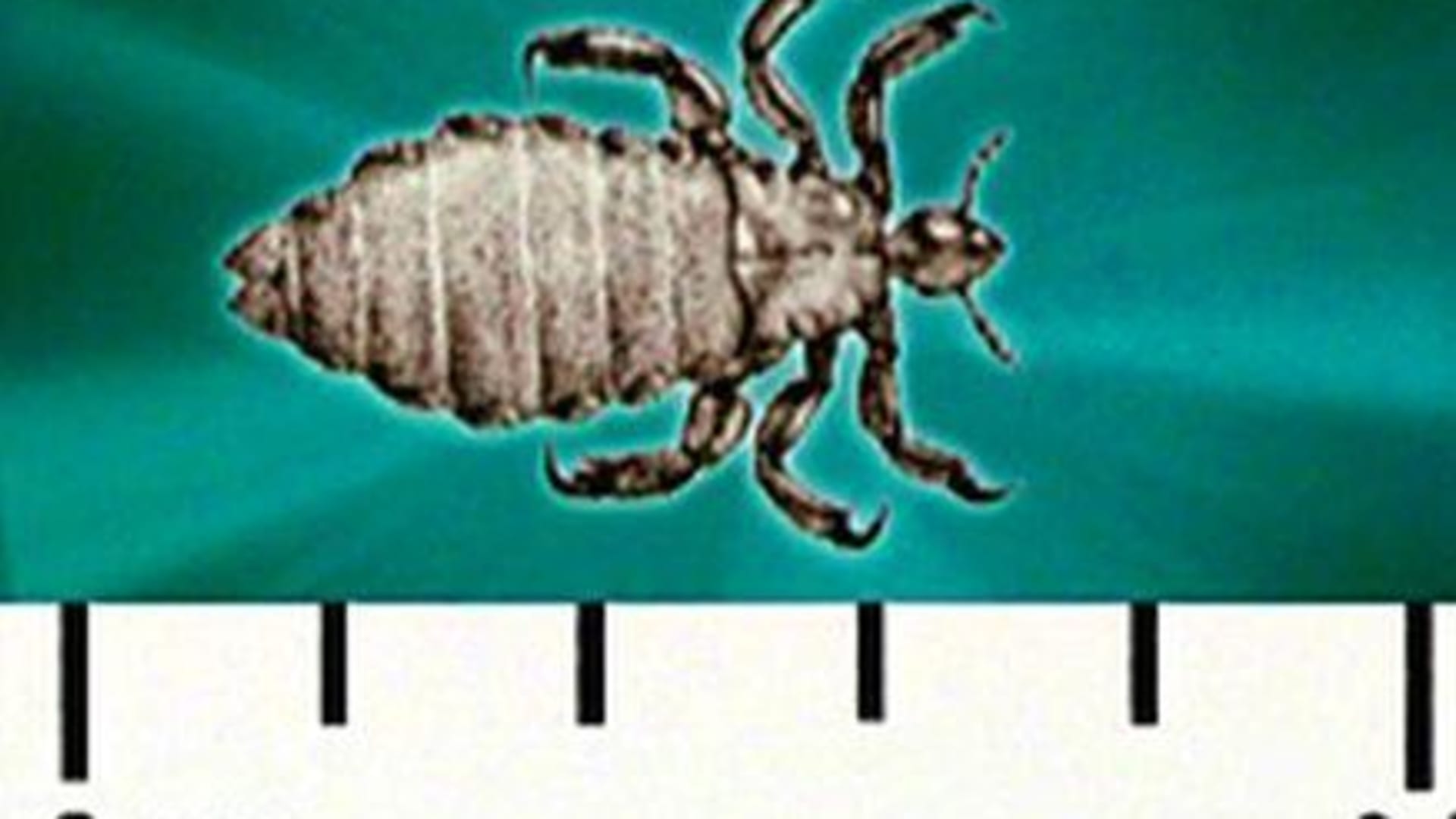 Reportage om huvudlöss och springmask | Yle Areena