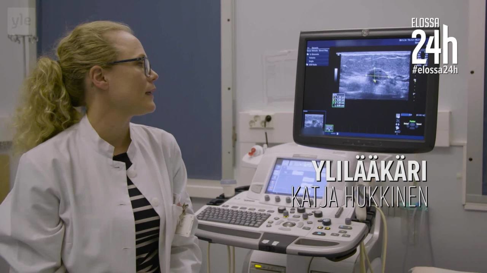 Elossa 24h: “Vähän erilainen rasvaimu” | Yle Areena