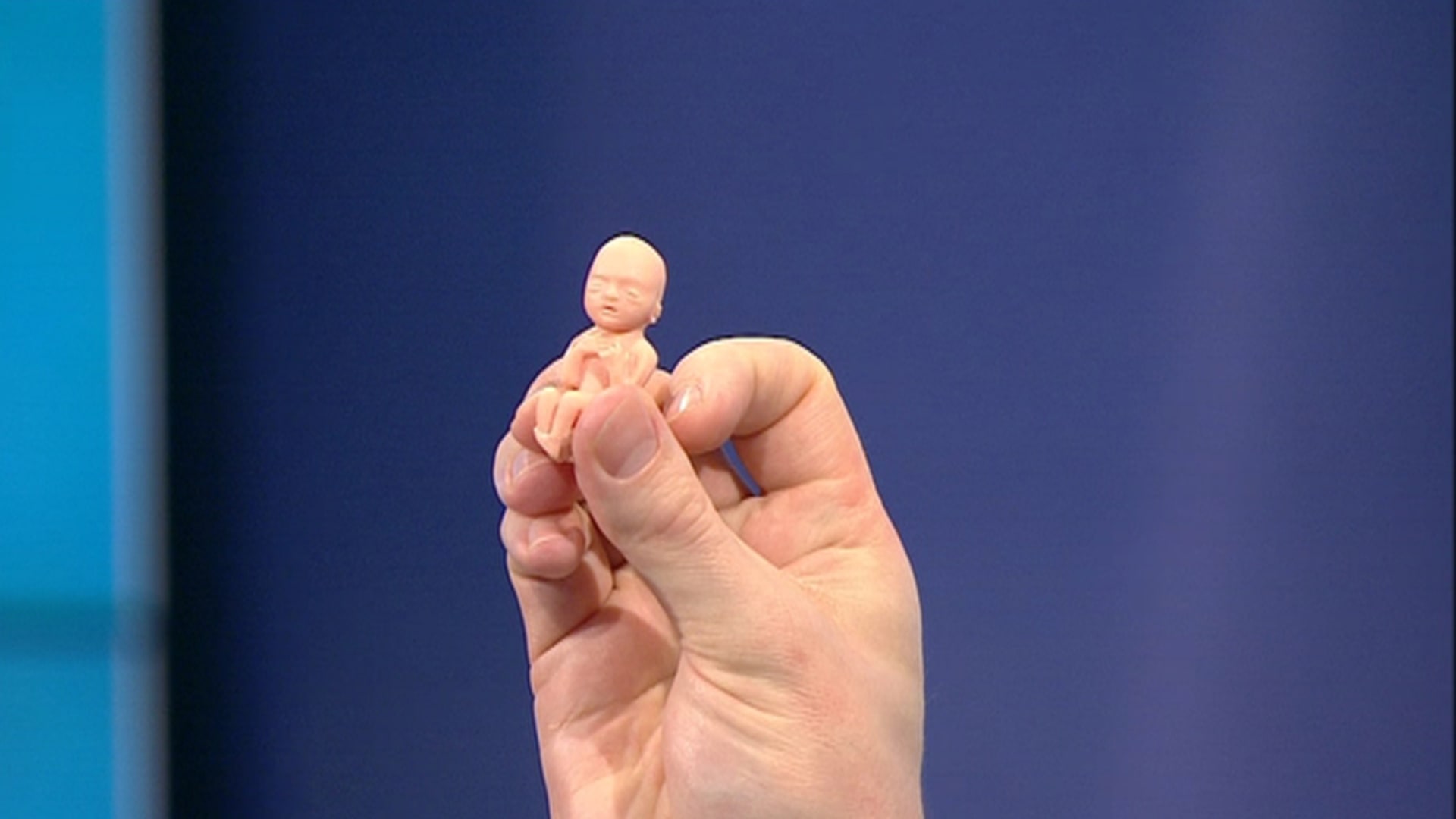 A-studio: Pakko tehdä abortti | Yle Areena