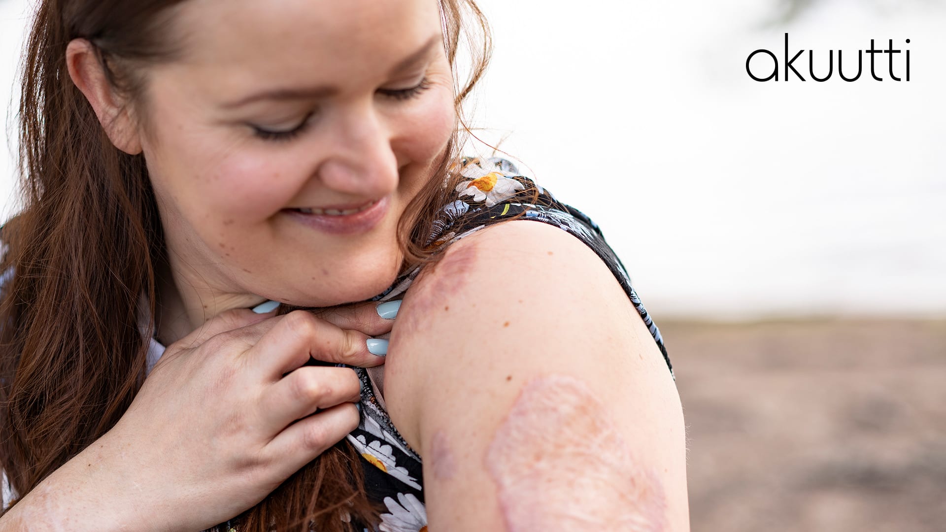 Resilienssi auttaa selviytymään | Akuutti | Yle Areena
