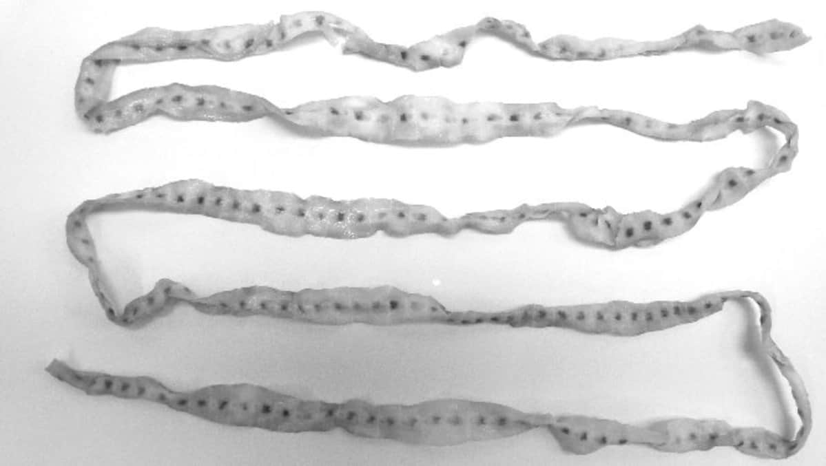 Lapamato voi pesiytyä nykyihmiseenkin – "Laihduin 8 kiloa" | Yle ...