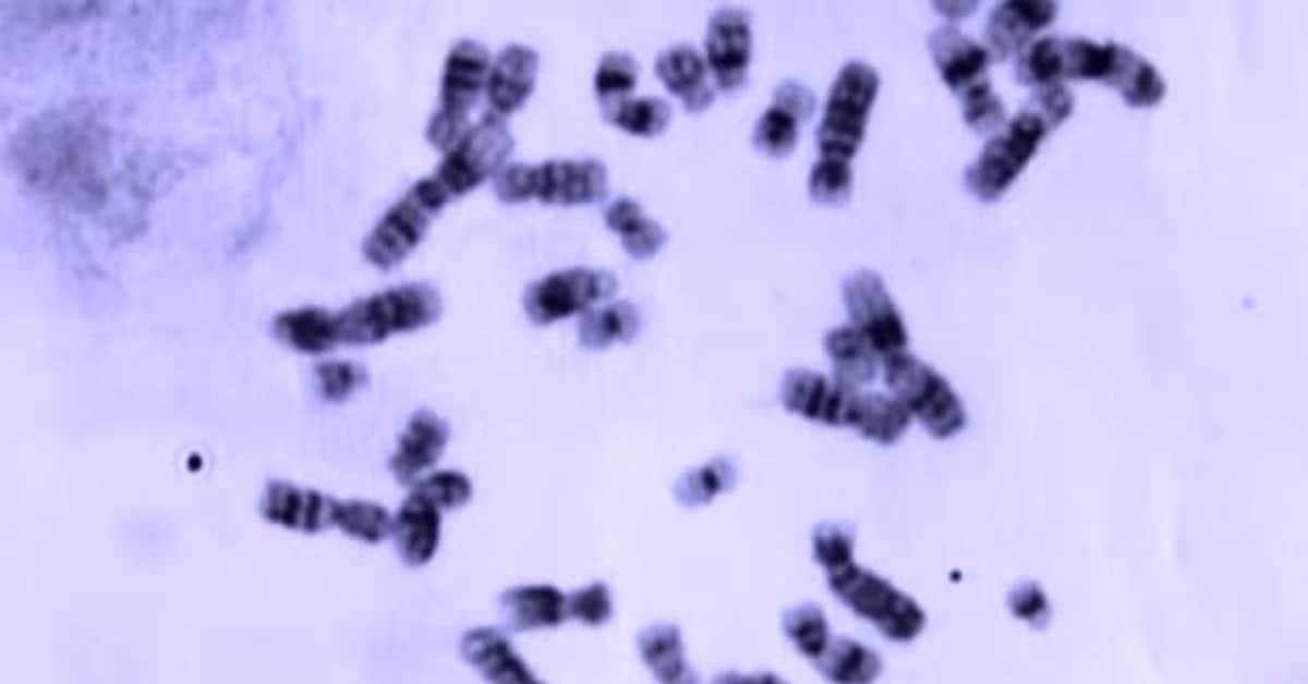 Tuma ohjaa solun toimintaa | Oppiminen | Yle