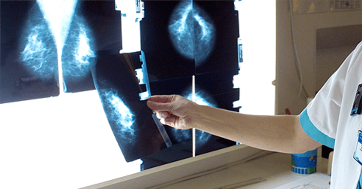 Radiologist shortage poses a danger | Yle