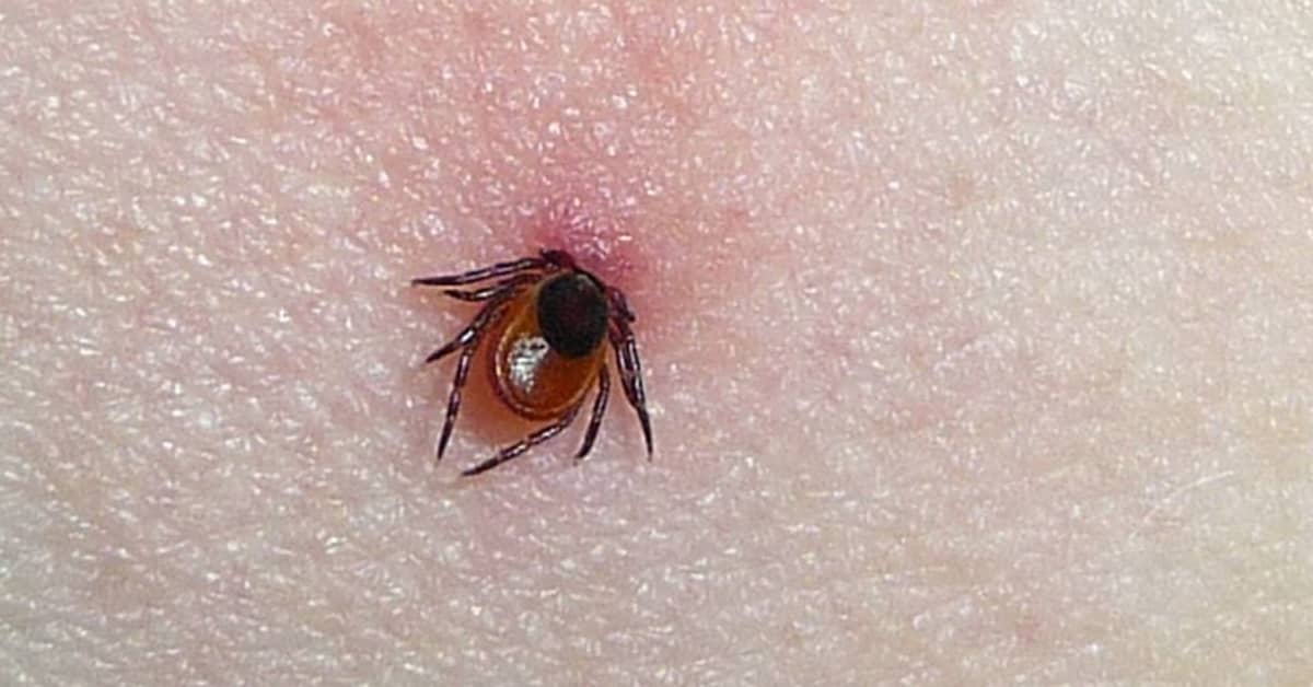 Älä luota kaikkiin punkki-uskomuksiin | Yle