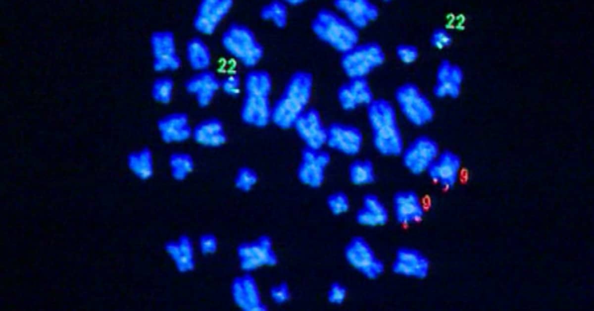 Finns in a Genetic Class of their Own | Yle