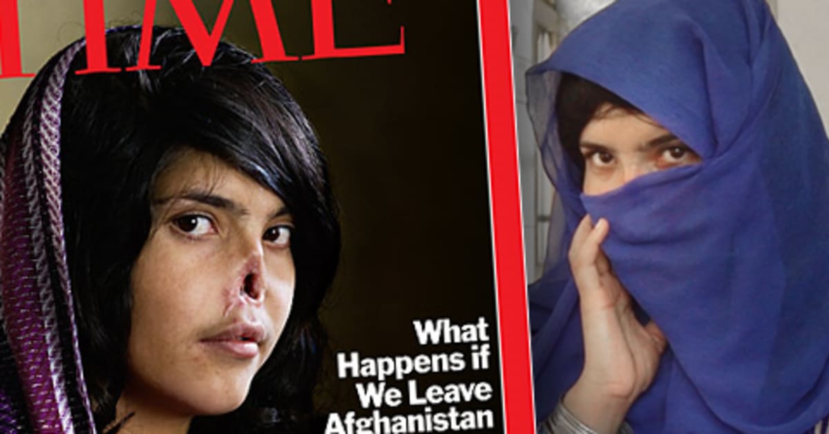 Disfigured Afghan Woman on Time Cover Also Got Finnish Help | Yle