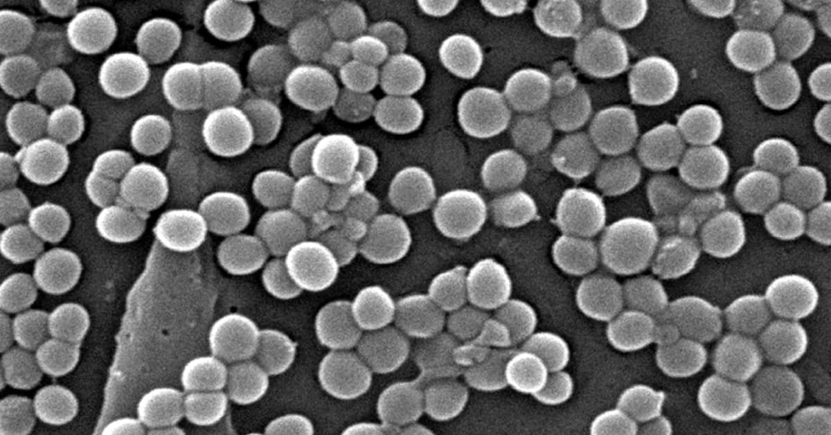 MRSA-bakteeri jyllää Tampereella | Yle