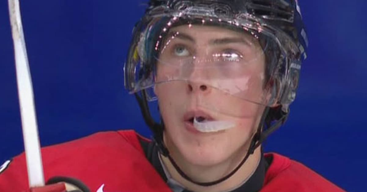 Edmonton saa "junnuketjun" takaisin - Nugent-Hopkins palaa jäälle | Yle