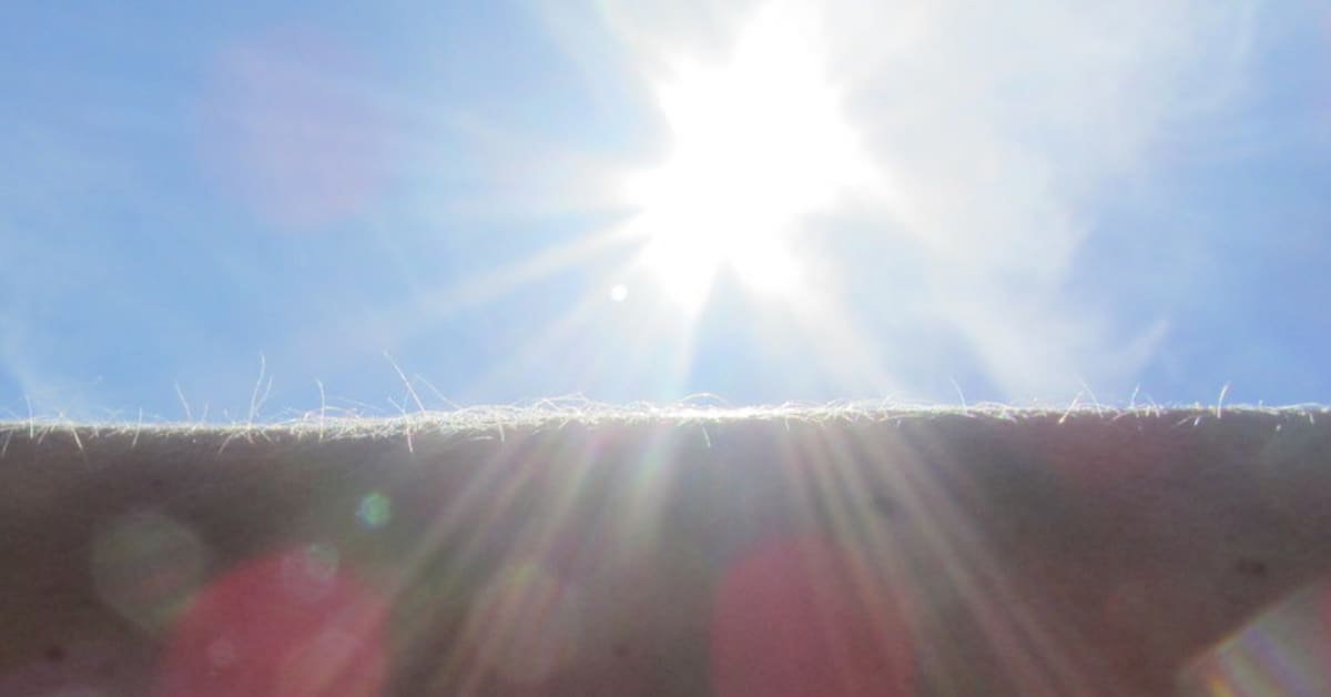 Petollinen yhdistelmä herkälle iholle: Aurinko ja kipugeeli | Yle
