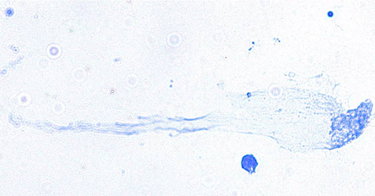 Läpimurto: Laboratoriossa valmistetulla spermalla hedelmöitettiin ...