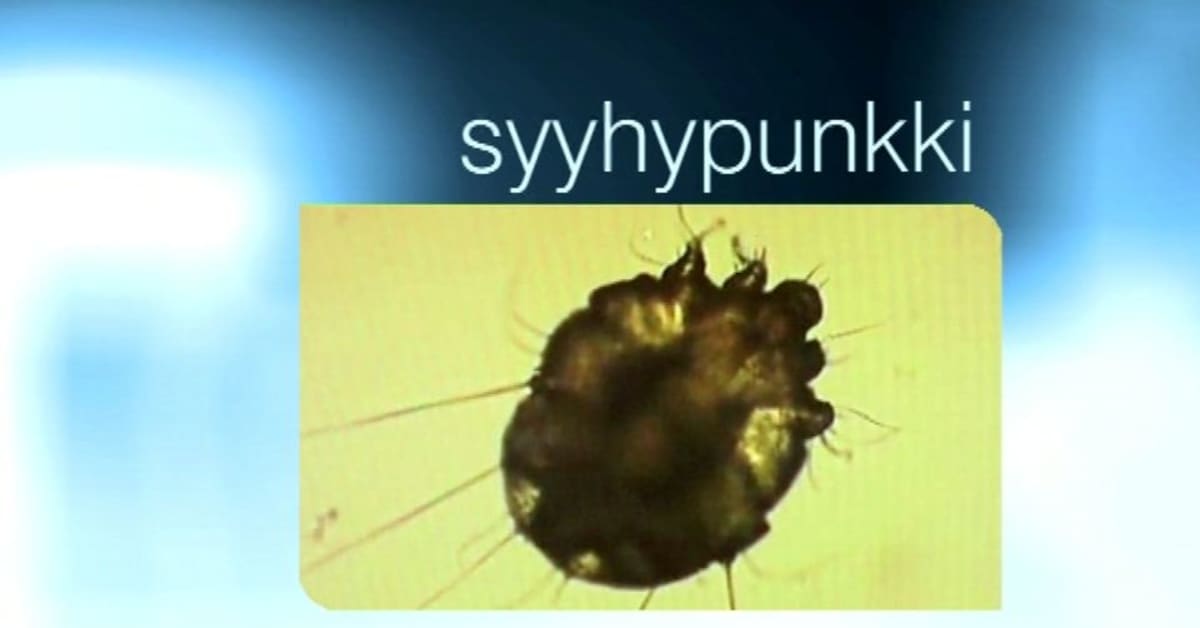 Syyhy on levinnyt vanhusten keskuudessa Ilomantsissa epidemiaksi | Yle