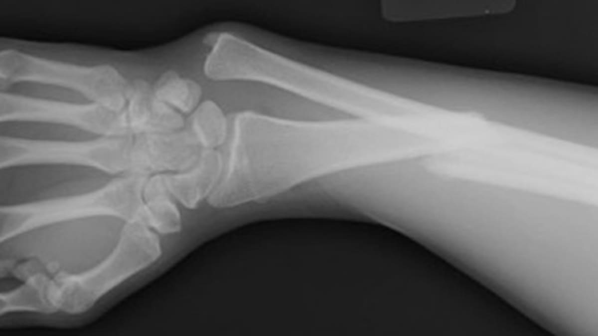 Omaisuus vakuutetaan paremmin kuin terveys | Yle Uutiset