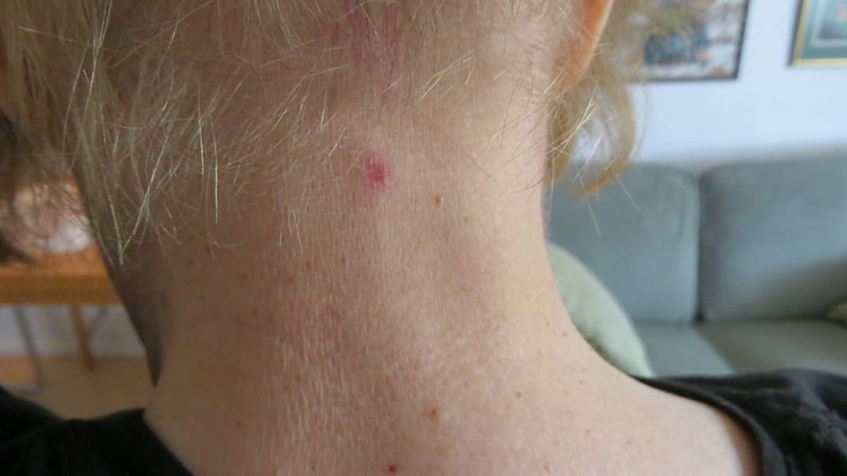 Tutkijoille terveisiä: Punkit liikkuvat jo Meri-Lapissa | Yle Uutiset